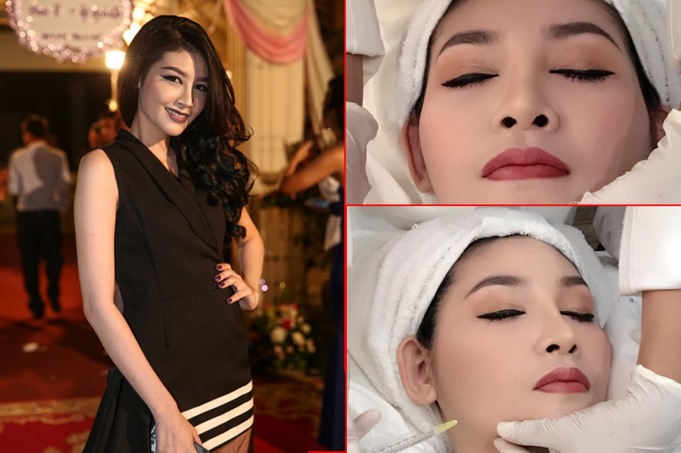 ធ្លាយ រឿង បេនីយ៉ាំង ទៅ ចាក់ បង្រួម ថ្គាម និង បឿ ក នៅ គ្លីនិក មួយ - Sabay News